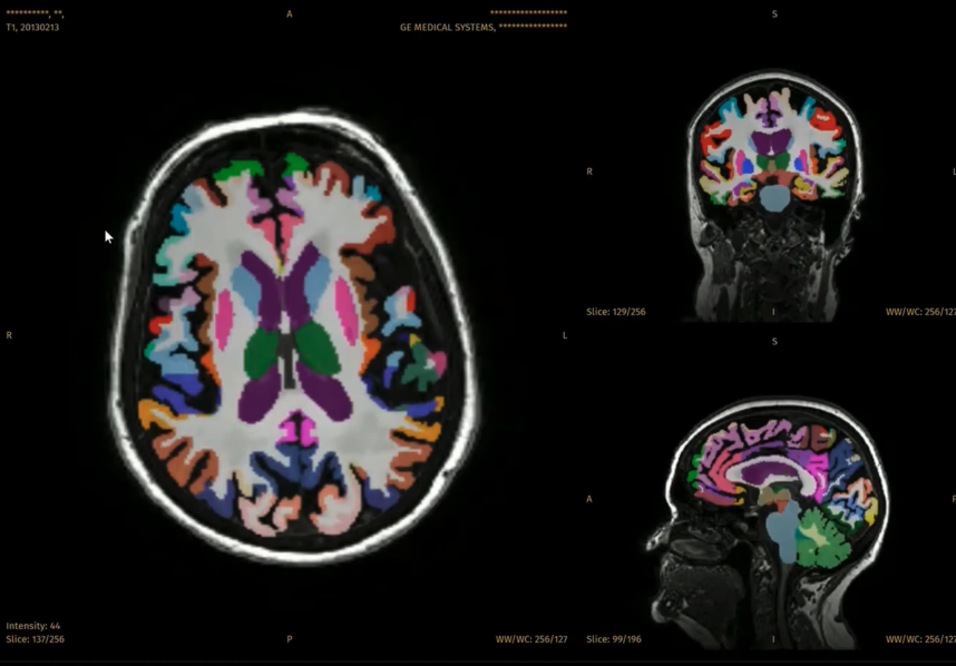 Combinostics - NordicNinja VC